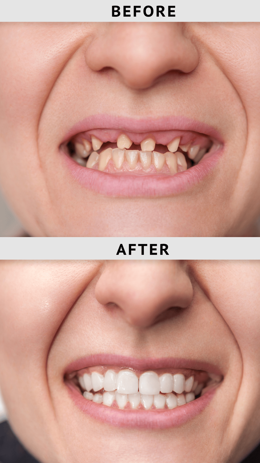 Fogpótlás - Elitdent